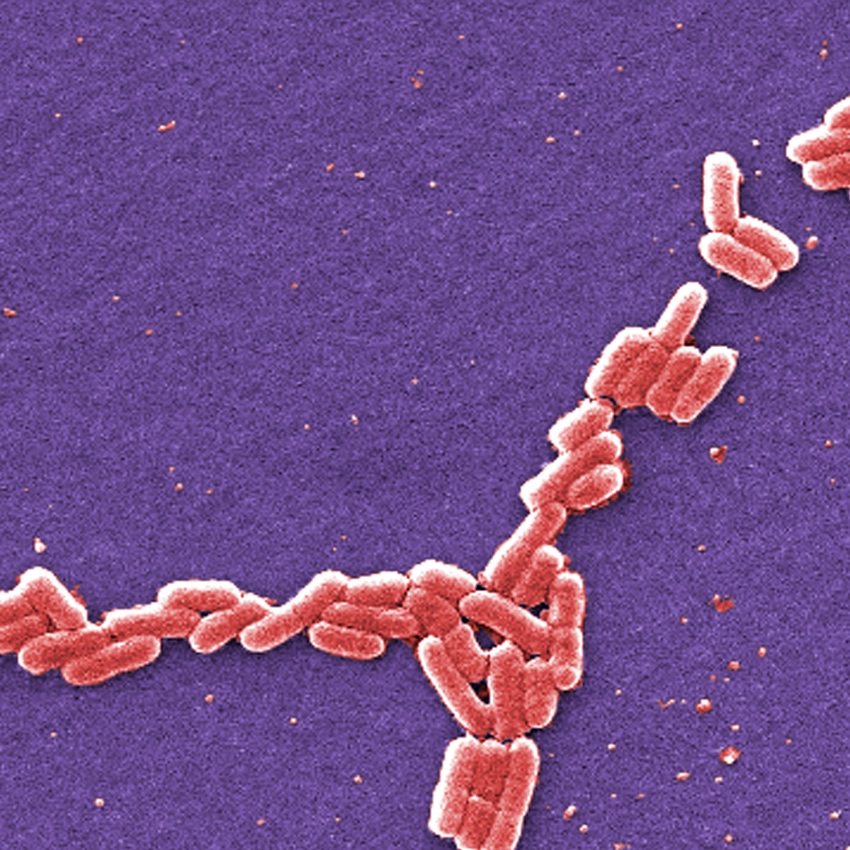 E Coli Infection e-coli-infection