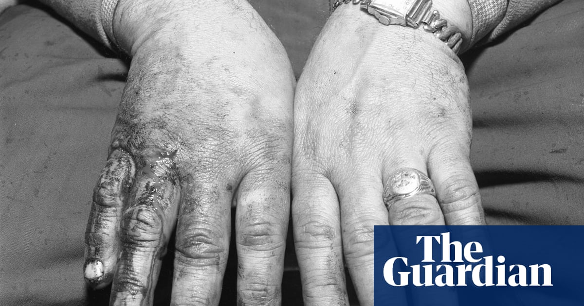 Destination Morgue James Ellroy Spills Las Crime Scene Secrets In